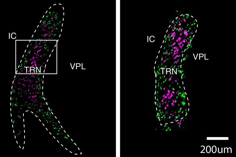 Mapping the brain’s sensory gatekeeper | Brain and Cognitive Sciences
