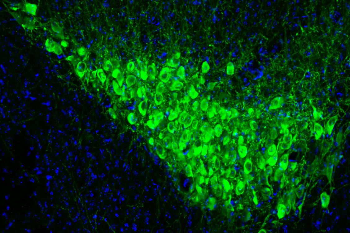 Scientists identify specific brain region and circuits controlling ...